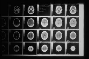 Neuroscience: The 10 Most Awe-Inspiring Studies - PsyBlog
